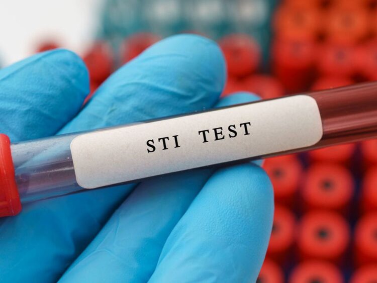 When to Go for an STI Check? - Videovor Media